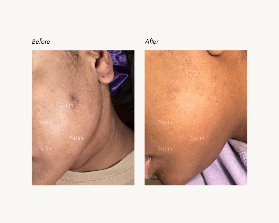 Noire Skincare - L'Éclat des peaux Noires et Métissées.